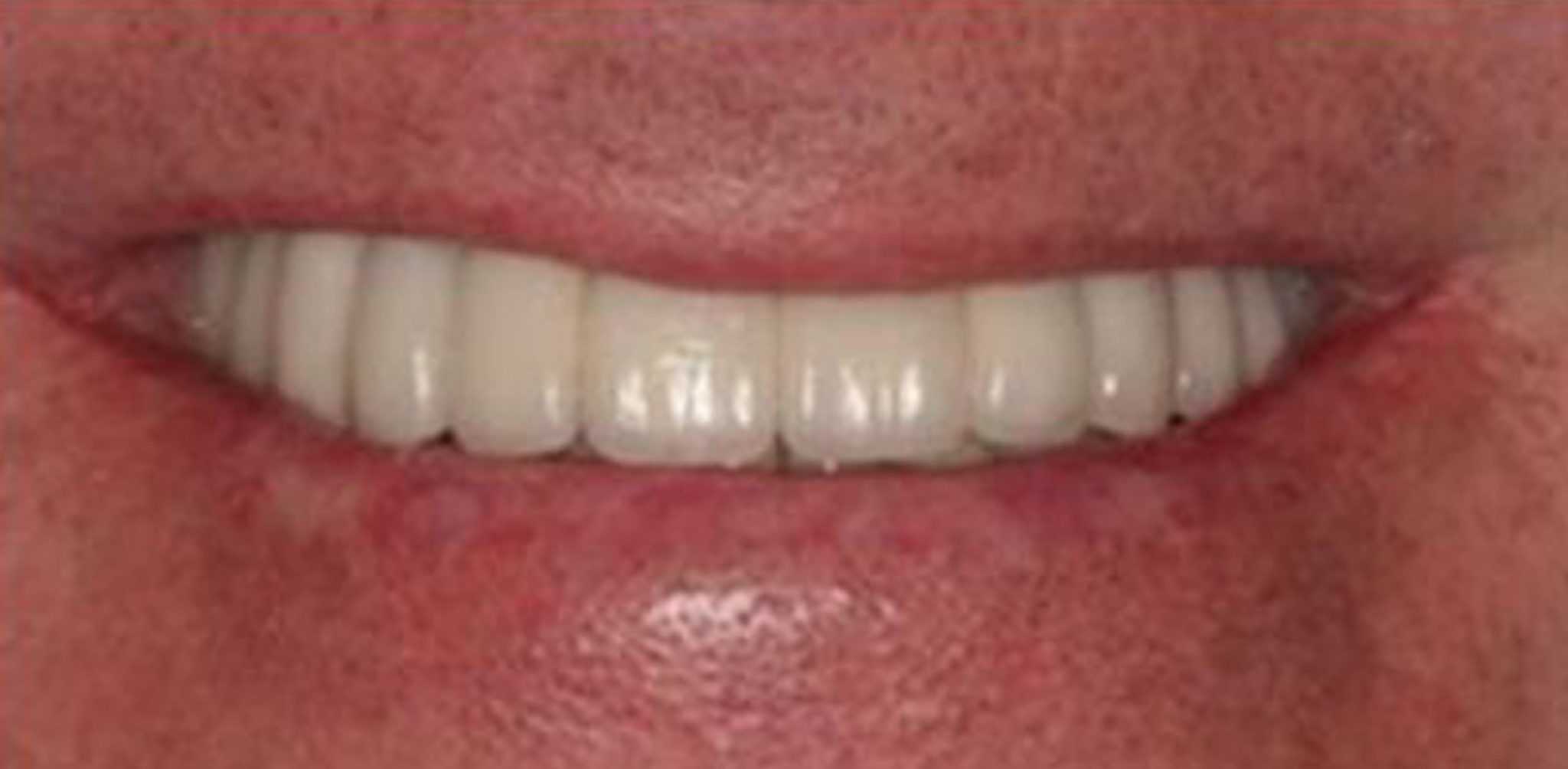 Dentist Office Whitby transforming smiles. | Margolian Dentistry